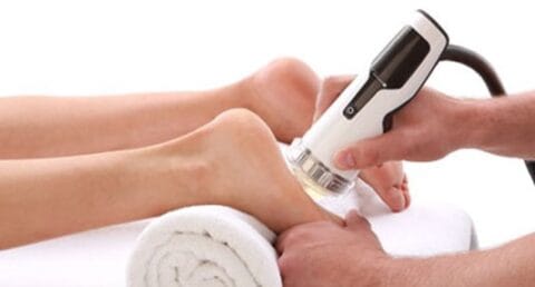 Shock Wave Therapy | Chiropractic Clinics of South Florida